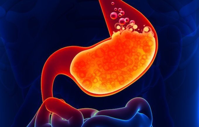How To Increase Stomach Acid Levels - THE IBS DIETITIAN